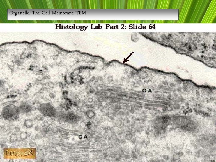 Cell Membrane Cytoplasm Nucleus Nucleolus Mitochondria Endoplasmic ...