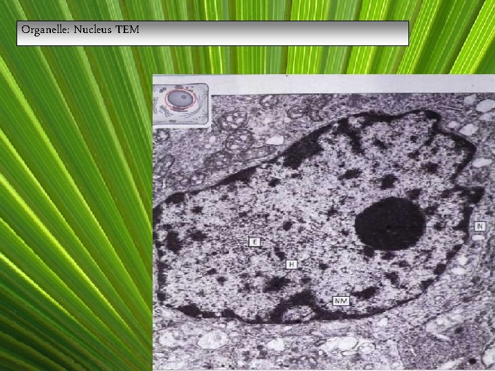 Cell Membrane Cytoplasm Nucleus Nucleolus Mitochondria Endoplasmic ...