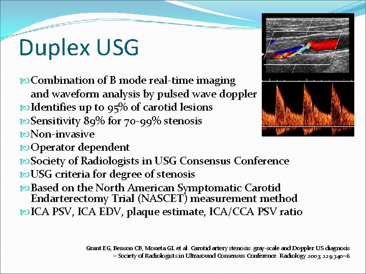 Carotid Artery Stenosis Department of Surgery Queen Elizabeth
