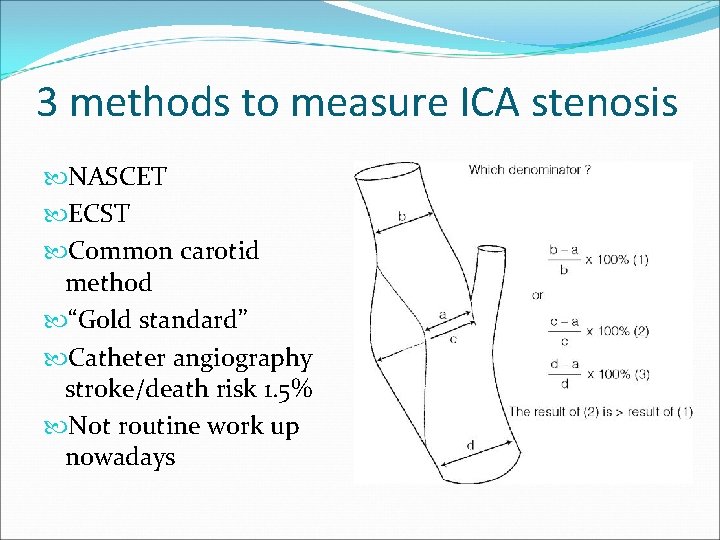 Carotid Artery Stenosis Department of Surgery Queen Elizabeth