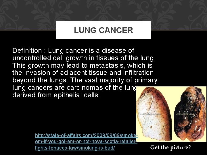 SMOKING Why do it to yourself Holly Marcinkiewicz
