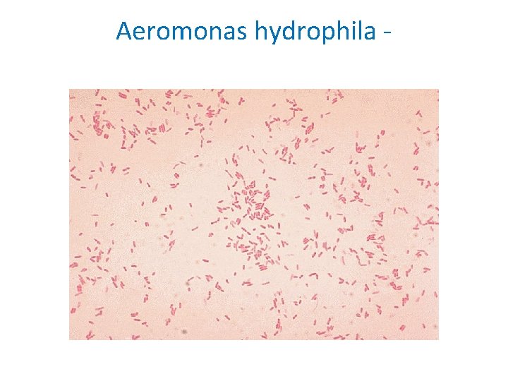 Important Bacterial Diseases of Fish Dr Deepak Kumar