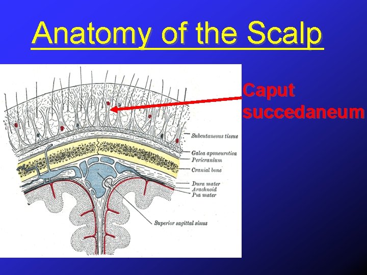 Lumps Bumps on the Newborn Head When should