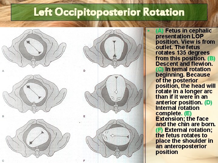 Fetal Malposition Refers to positions other than an