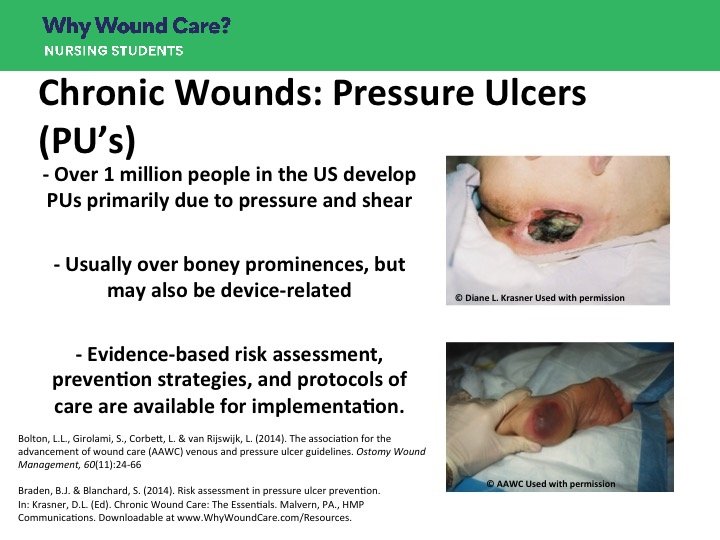 Common Types of Wounds Diane L Krasner Ph