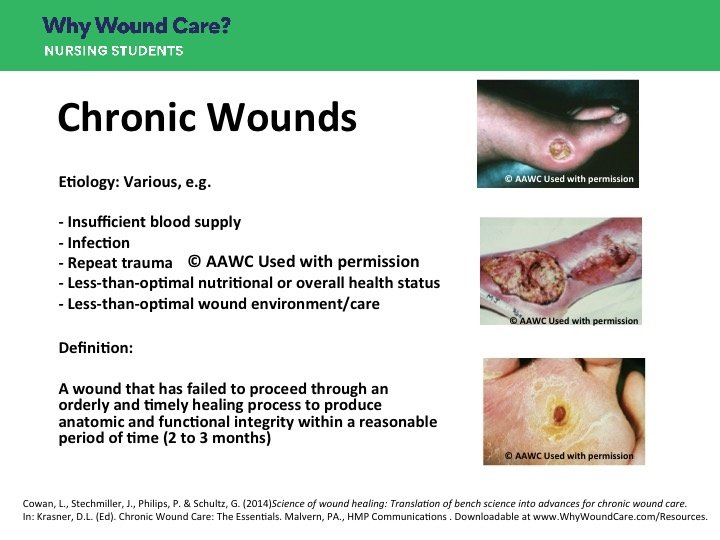 Common Types of Wounds Diane L Krasner Ph