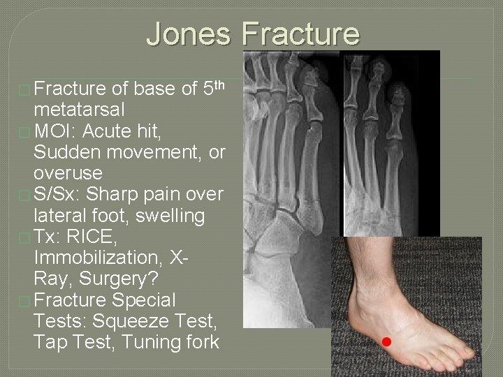 The Foot The foot functions to absorb forces