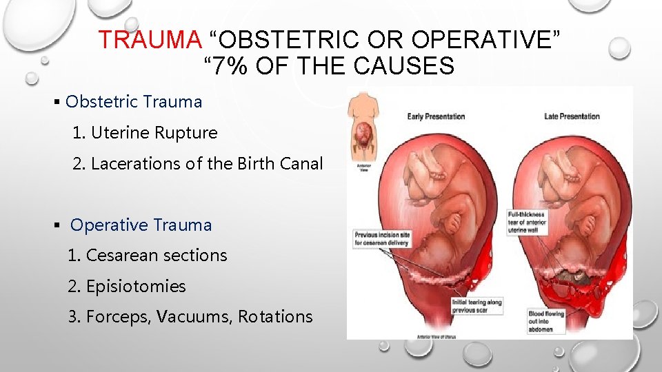 POSTPARTUM HEMORRHAGE DR MUNIRA DILAWER GHEEWALA DEFINITION OF