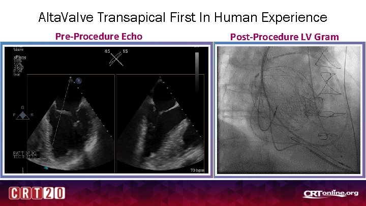 Experience on Early Feasibility Studies US Industry View