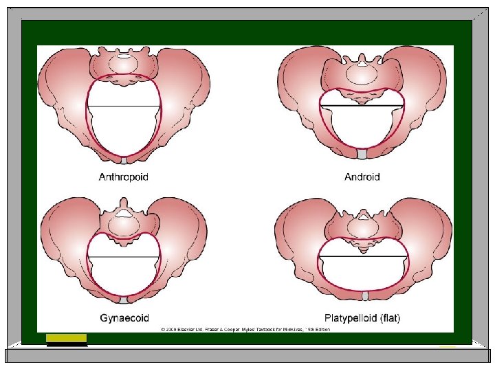 CH 8 The Female pelvis and reproductive organs