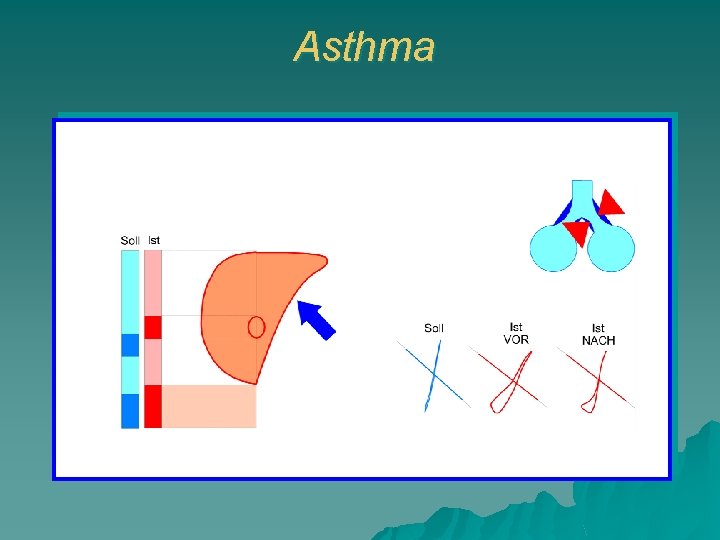 An Approach For Spirometry and DLCO Interpretation Airway