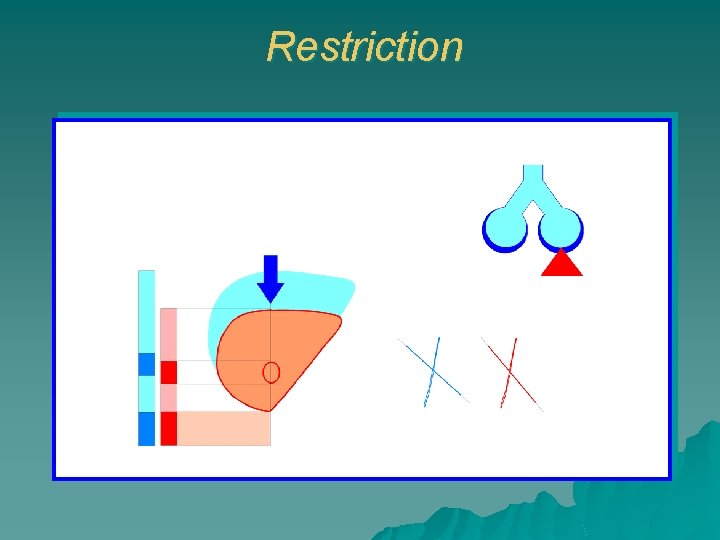 An Approach For Spirometry and DLCO Interpretation Airway