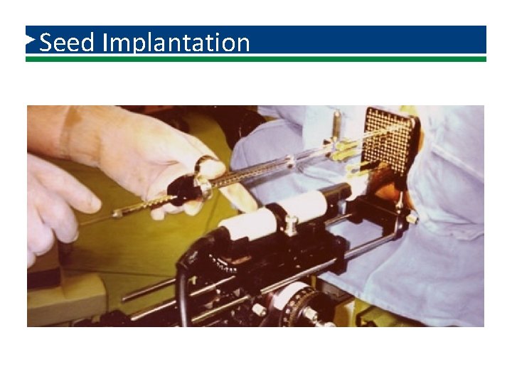 Permanent Brachytherapy Medical Events Experiences of Pennsylvania Frank