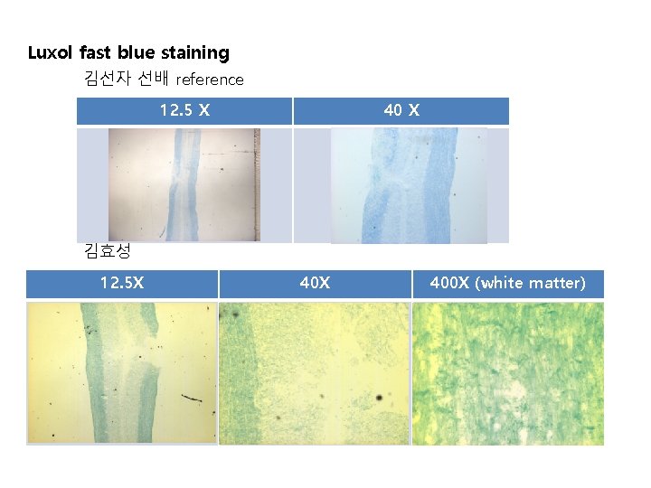 Luxol fast blue staining reference 12 5 X