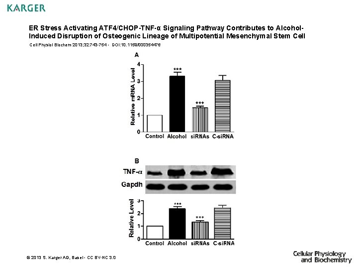 ER Stress Activating ATF 4CHOPTNF Signaling Pathway Contributes