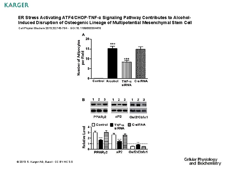 ER Stress Activating ATF 4CHOPTNF Signaling Pathway Contributes