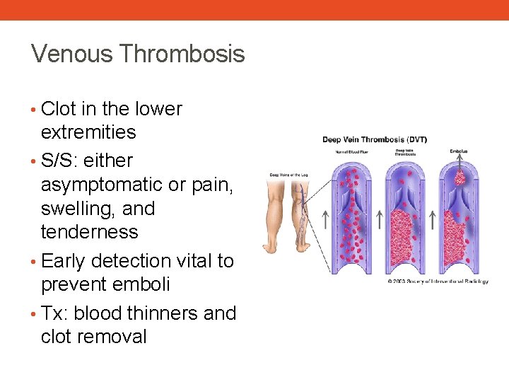 CHAPTER 6 Diseases of the Cardiovascular System EPISODE