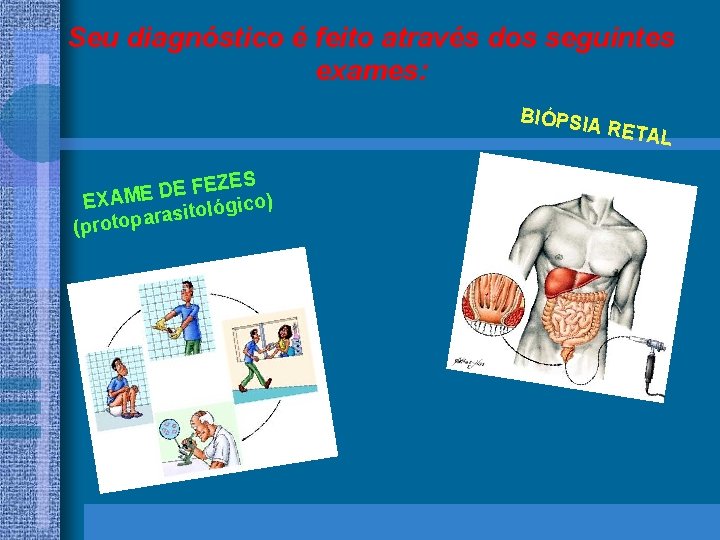 Esquistossomose Doena causada pelo verme Schistosoma mansoni Ataca