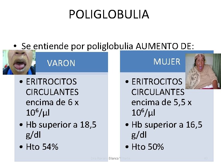 RECUENTO ERITROCITARIO HEMOGLOBINA HEMATOCRITO VCM HCM CCMH CARACTERSTICAS