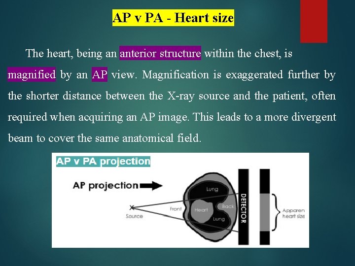Chest xray HOW TO INTERPRET CHEST XRAY By