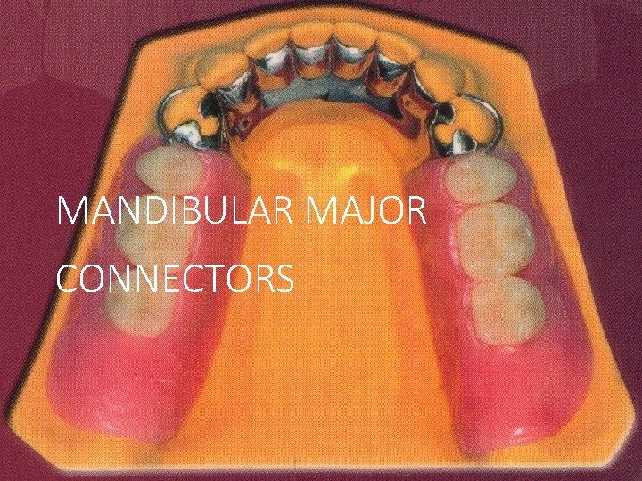 Major Connectors MANDIBULAR MAJOR CONNECTORS Contents Introduction ...