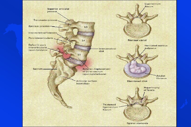 The evaluation and management of low back pain