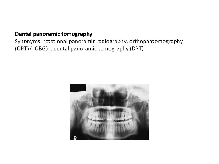 Dental radiology Tooth anatomy Crown The visible part