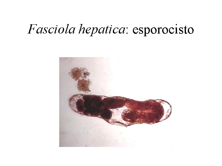 Trematodes Generalidades Platelmintos no segmentados Acelomados ...