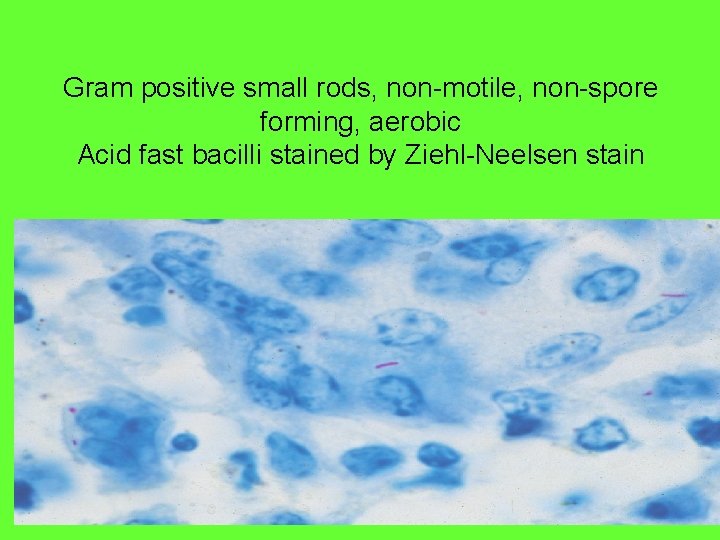 Bovine Tuberculosis Synonyms Tuberculosis Pearly disease Definition TB
