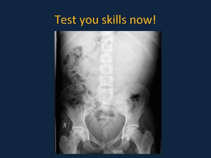 Part 3 0 Standardised Interpretation of Paediatric AXR