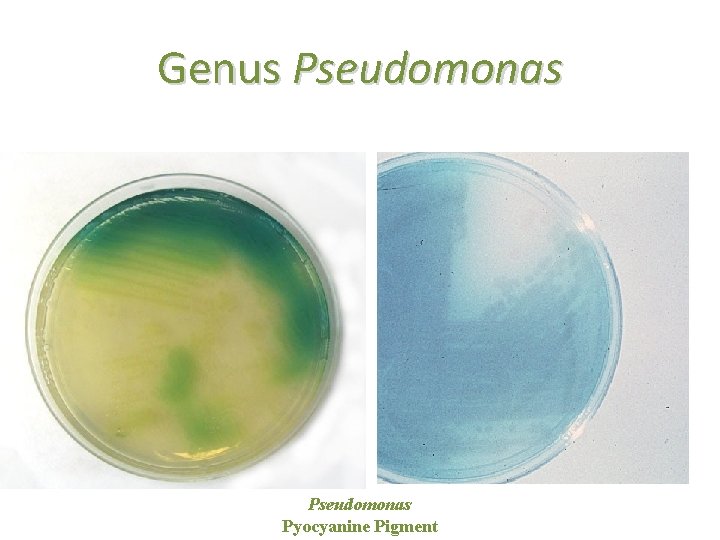 Gram Negative Bacilli Family Enterobacteriaceae Genus Proteus Species
