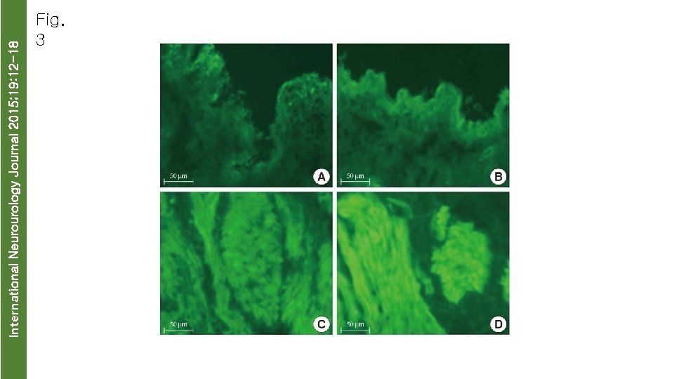 International Neurourology Journal 2015 19 12 18 Role