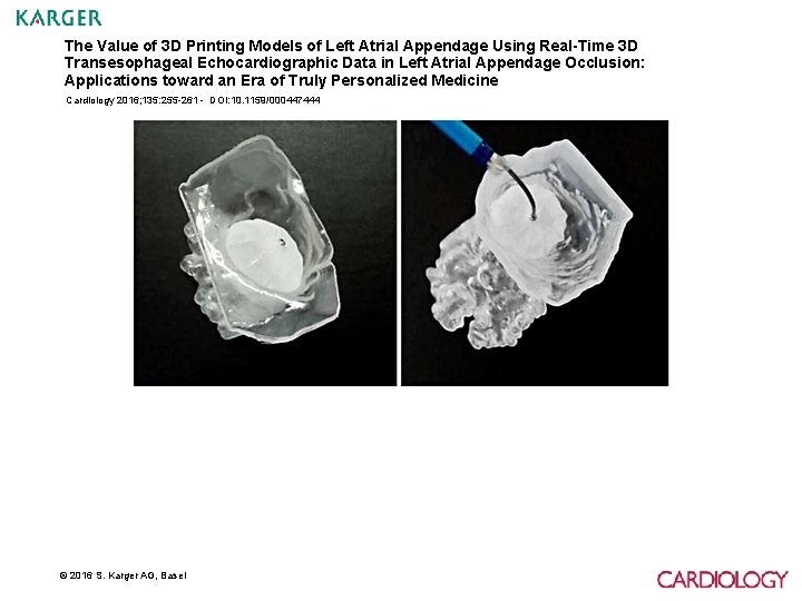 The Value of 3 D Printing Models of