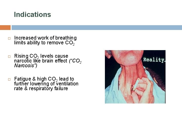 CONTINUOUS POSITIVE AIRWAY PRESSURE DEVICES ALS BLs Continuing