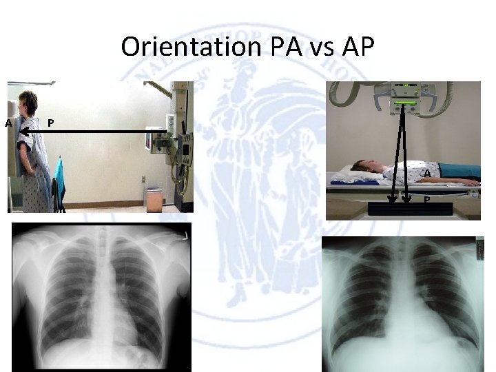 Radiology Back to Basics ACPA 2018 Dr Michael