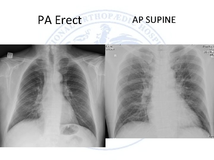 Radiology Back to Basics ACPA 2018 Dr Michael
