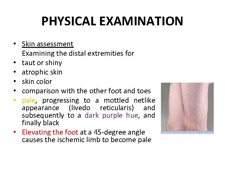 ARTERIAL ULCERS INTRODUCTION Arterial ulcers also referred to