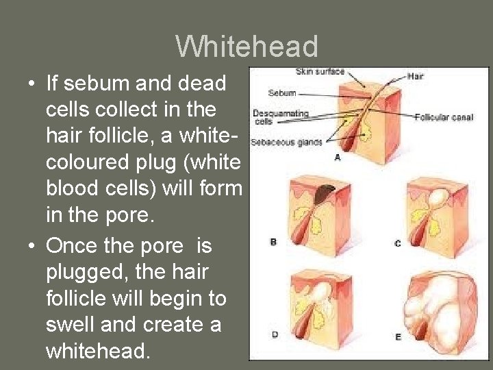 Pimples Nails Moles Warts Skin Cancer Birthmarks and