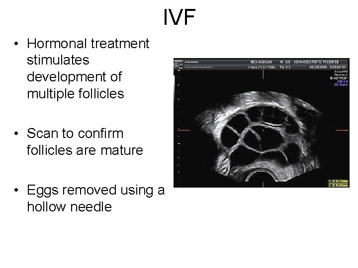 Biology of Fertility Control What You Should Know