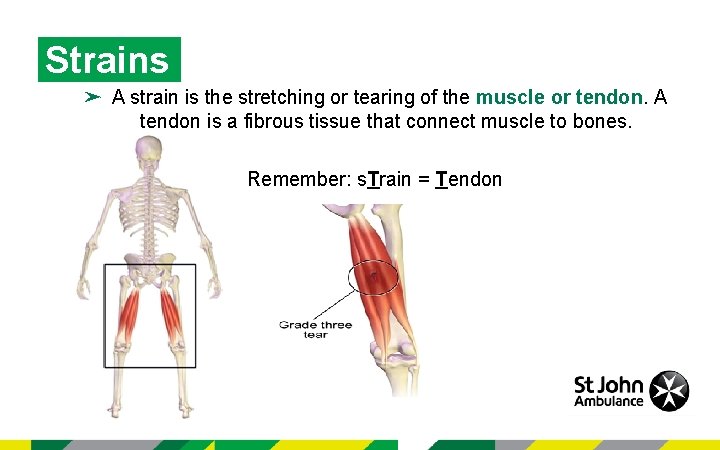 Bone muscle and joint injuries KS 4 Bone