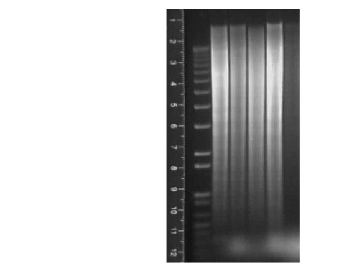 Southern Blotting Dr Sameera Hassan Assistant Professor 5