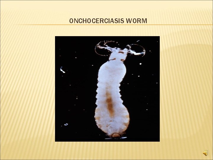 PUBLIC HEALTH IMPACT OF ONCHOCERCIASIS DISEASE IN NIGERIA