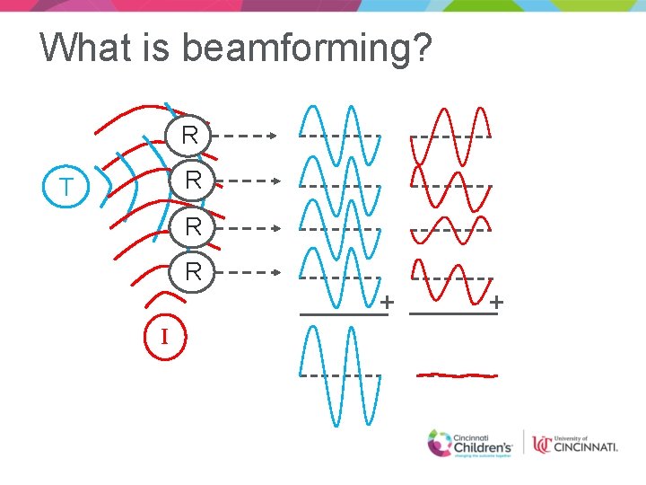 Practical Aspects of Beamformers in Pediatric Epilepsy Jeffrey