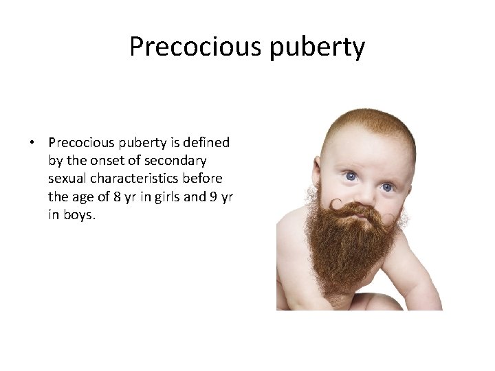 Normal and abnormal puberty Tariq Rabaya MD July