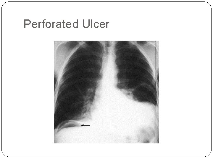 EXAMINATION OF AN ACUTE ABDOMEN Dr Massaga Lecturer