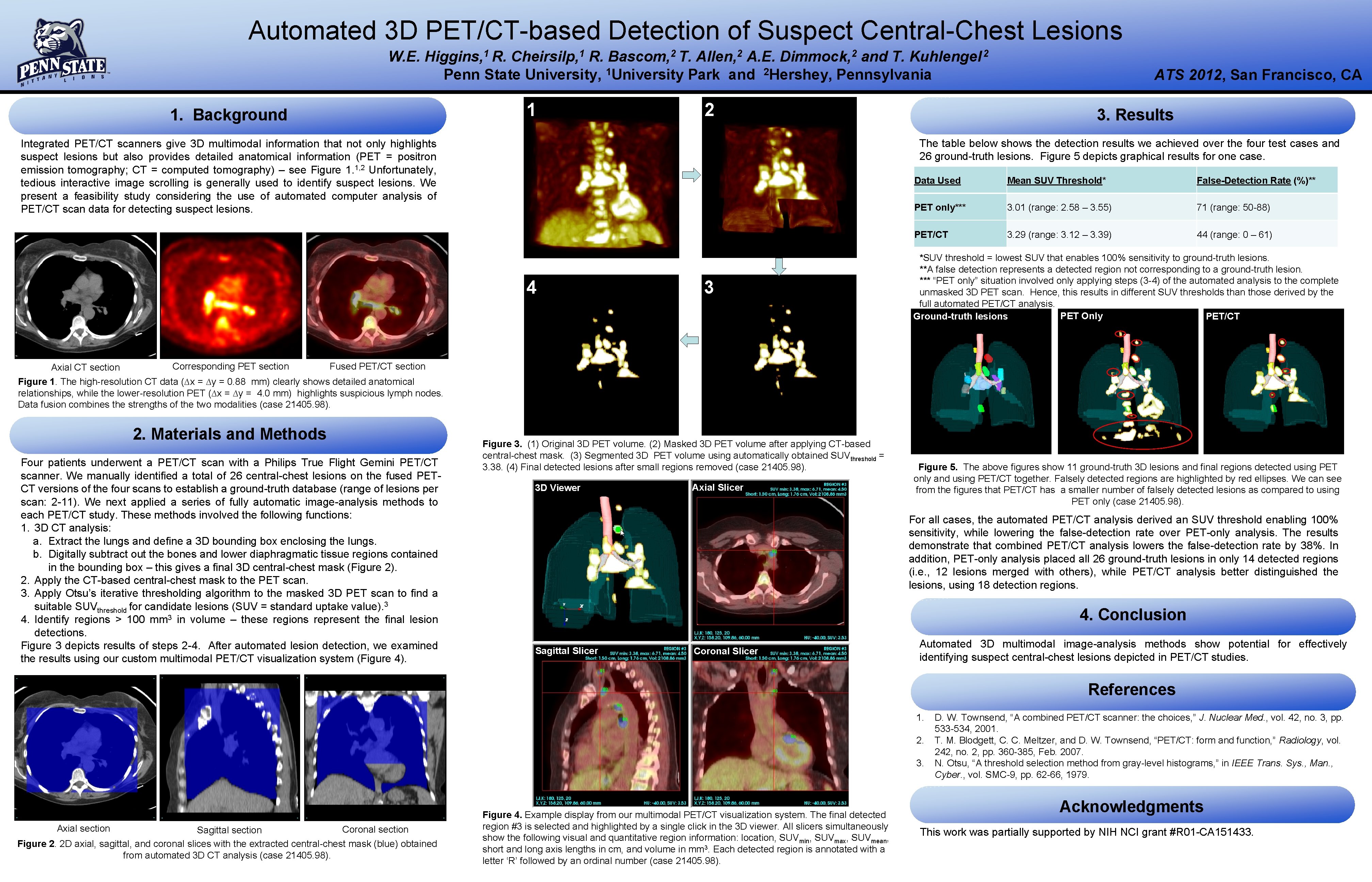 Automated 3 D PETCTbased Detection of Suspect CentralChest