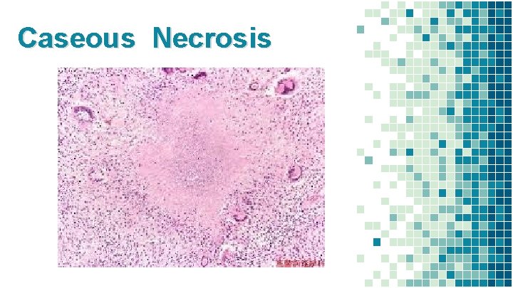 Cell Injury and Necrosis2 Ghadeer Hayel MD 2