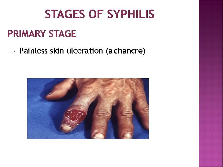 DRUGS USED FOR THE TREATMENT OF SYPHILIS GONORRHEA