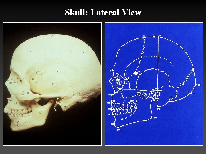 Craniometry and Functional Craniology Part I Anthropometry Craniometry