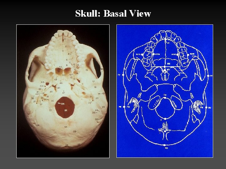 Craniometry and Functional Craniology Part I Anthropometry Craniometry